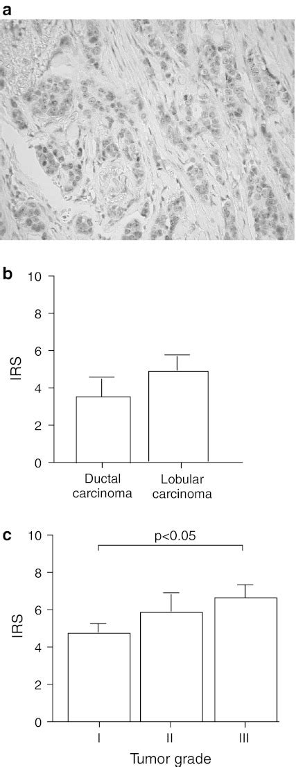 Immunohistochemical Analysis Of Topbp1 Protein Expression A