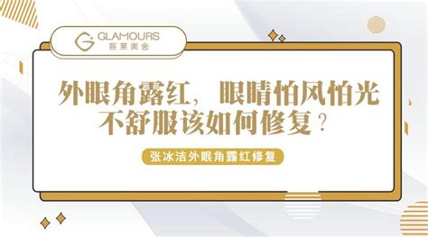 张冰洁外眼角露红修复丨外眼角露红，眼睛怕风怕光不舒服该如何修复？ 知乎