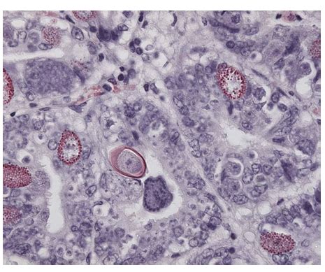 Parasitology Lecture 37 Parasitic Protozoa Of The Phylum Apicomplexa