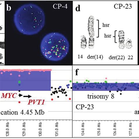 Detection Of A Supernumerary Der 21 T 12 21 Chromosome By Array CGH Download Scientific