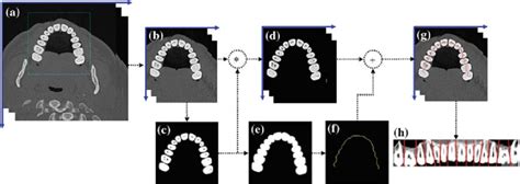 Several Steps Of The Proposed Segmentation Techniques A A Typical