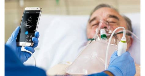 Philips Dia Imaging Analysis To Enhance Ultrasound With Ai Based Image Quantification Axis