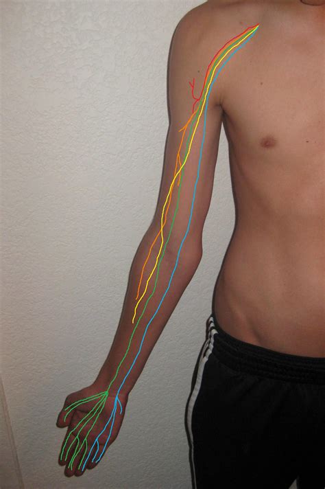 The Brachial Plexus