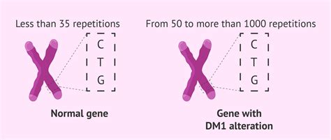 Genetic Alteration Of Steinerts Myotonic Dystrophy