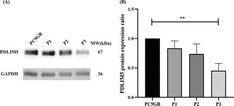 Expression Of Pdlim5 In Pc9gr Cells A And B Western Blot Analysis Of Download Scientific