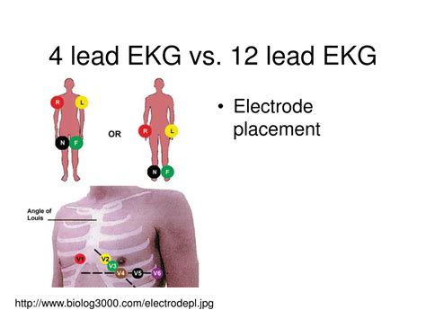 Ppt Ekg Powerpoint Presentation Free Download Id4371250