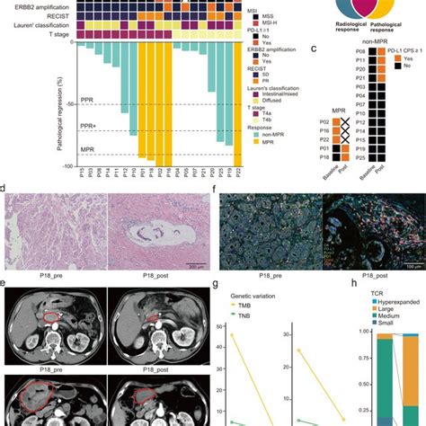 Immune Cell Deconvolution And Association With Responses To Neoadjuvant Download Scientific