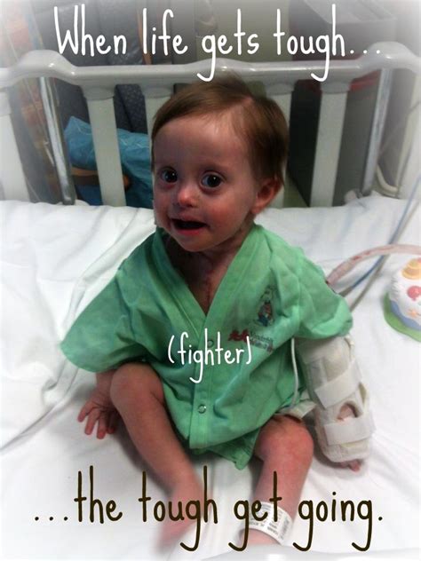 39 Best Down Syndrome Images On Pinterest Down Syndrome Awareness