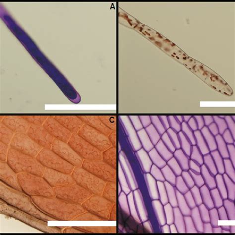 Light Microscopy Image Of A Young Protonemal Colony Of Physcomitrella