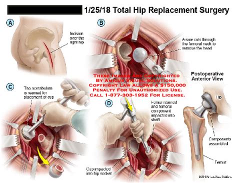 Medical Exhibits Demonstrative Aids Illustrations And Models