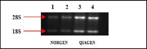 RNA Integrity Check For Samples Extracted From Norgen And Qiagen RNA Download Scientific