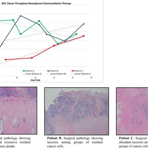 Functional Diffusion Map FDM Showing Longitudinal Pixel Wise Download Scientific Diagram