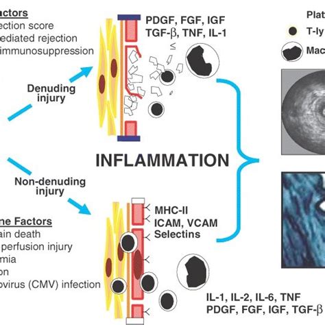 Cardiac Allograft Vasculopathy Is Initiated And Propagated By Both