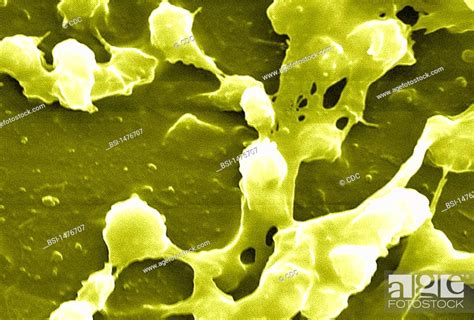 Staphylococcus Aureus Staphylococcus Aureus In Biofilm Coming From The
