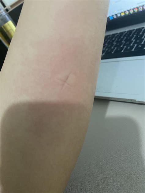 Lagyan Ng Oitnment Lagyan Ng X Ritookapictureph