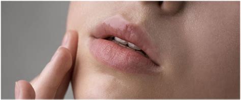 Trik Atasi Bibir Kering Akibat Rokok Pakai Lip Balm Dari 1 Jenis