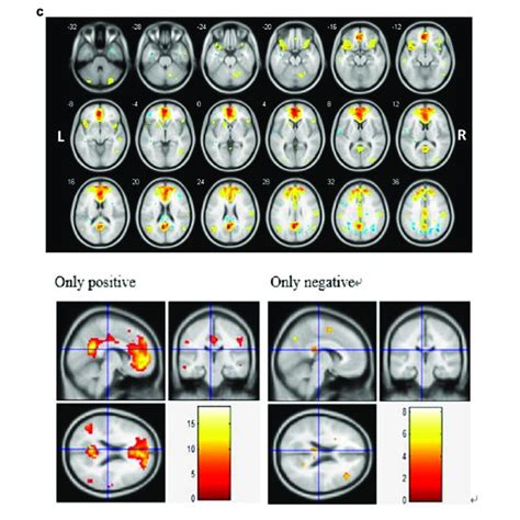 A Regions Showing Significant Differences In Default Mode Network