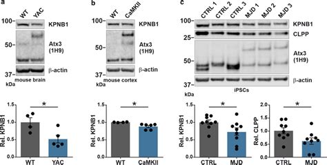 Mjd Transgenic Mouse Models And Ipscs Of Mjd Patients Exhibit Reduced