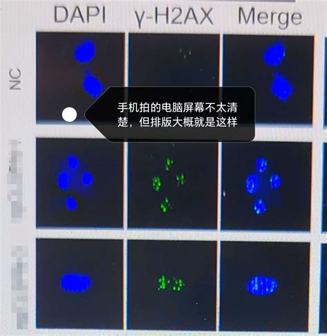 免疫荧光实验指南：γh2ax灶的检测