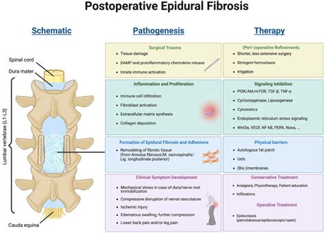 Postoperative Epidural Fibrosis Challenges And Opportunities A