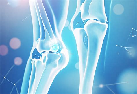 Corrective Osteotomy A Minimally Invasive Solution Healthtrip