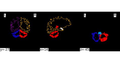 Compute Mne Inverse Solution On Evoked Data With A Mixed Source Space