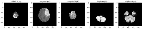 Brain Tumor Detection Using Deep Learning Download Scientific Diagram