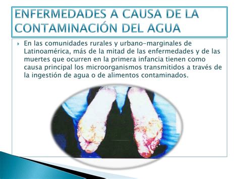 PPT CONTAMINACIÓN DEL AGUA PowerPoint Presentation free download
