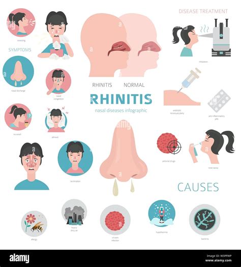 Nasal Diseases Rhinitis Symptoms Treatment Icon Set Medical Infographic Design Vector