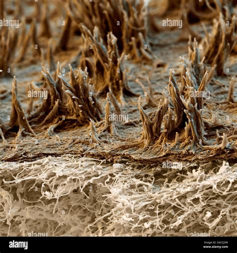 Fungal Surface Coloured Scanning Electron Micrograph Sem Of The