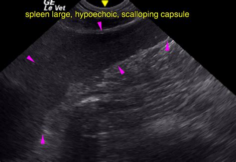 Multifocal Diffuse Neoplastic Infiltrate Likely Round Cell Involving Spleen Pancreas Liver