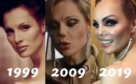 Carmen Campuzano Anhela Recuperar Su Nariz Y Ya Buscó Ayuda De Los