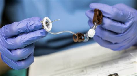 Long Term Catheters Ruge Vascular Centre Belagavi