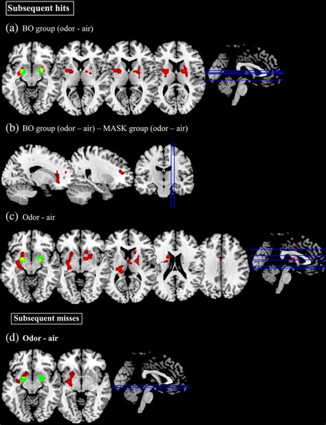 Brain Activation Maps Showing Significant Cluster Of Activation For The Download Scientific