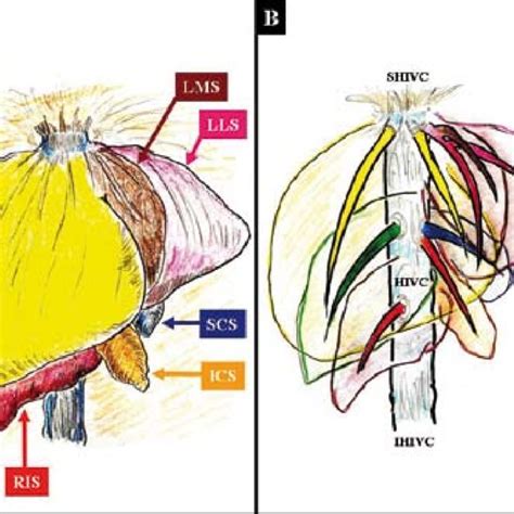 Pdf Surgical Guide Including Innovative Techniques For Orthotopic