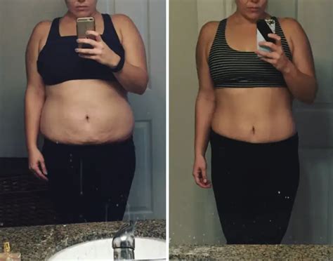 Semaglutide Weight Loss Before And After In Bradenton Weight Loss