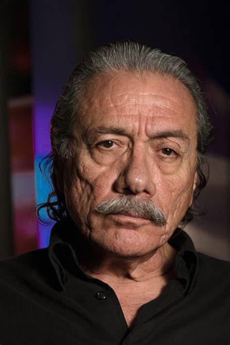 Edward James Olmos Scars