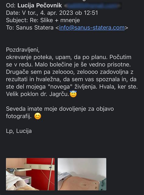 Kaj je diastaza rektusov in nov način za kirurško odpravo Sanus Statera