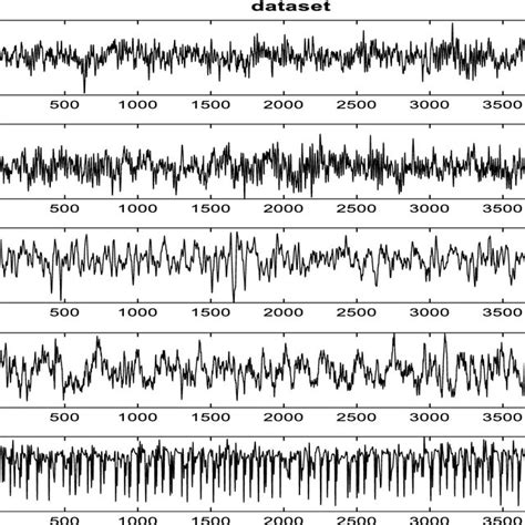 An Automated Classification Of Eeg Signals Based On Spectrogram And Cnn For Epilepsy Diagnosis