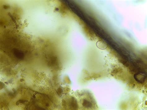 55 Questions With Answers In Protist Science Topic