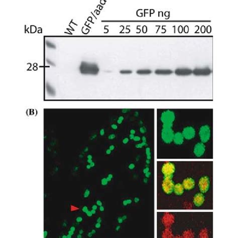 GFP Accumulation In Transplastomic Lettuce Callus Cell Lines A