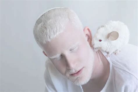 Behold The Mesmerizing Beauty Of Albino People