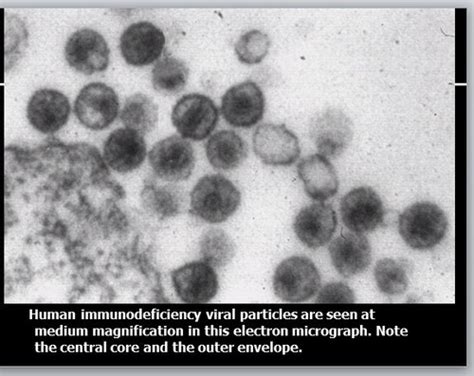 Virology Sexually Transmitted Diseases Caused By Viruses Flashcards