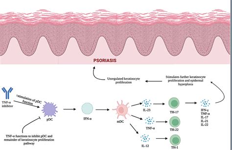 Systemic Immune Inflammation Index Useful Marker For Monitoring