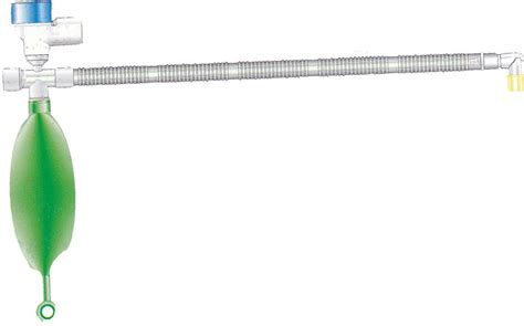 2021 Bain Mapleson Circuit At Best Price In Thane By Oam Surgical Equipments And Acessories Id