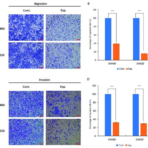 Migration And Invasion Confirmation Test By Sitspan5 A Evaluation Of