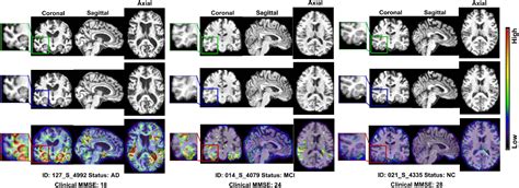 Figure 4 From Brain Status Transferring Generative Adversarial Network