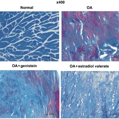 Immunohistochemical Identification Of Collagen Ii In Human
