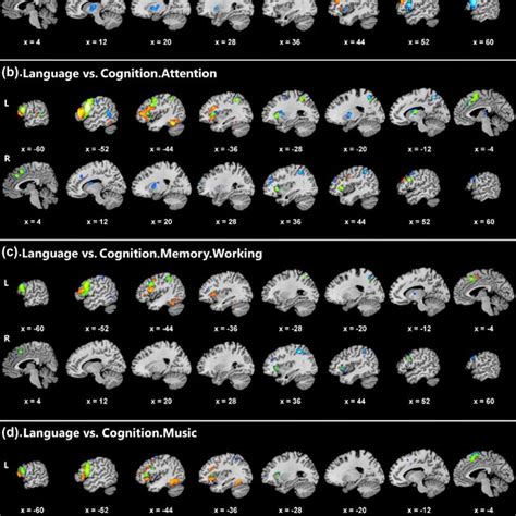 Results Of Contrast And Conjunction Analyses Between The Language