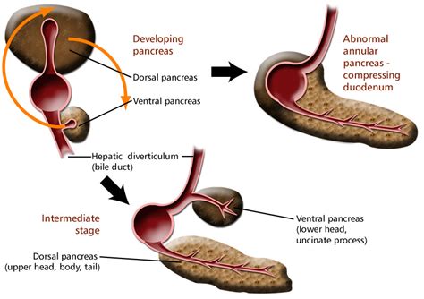 Pancreas Diagram Labeled Pancreas Labeled Stock Illustrations 98